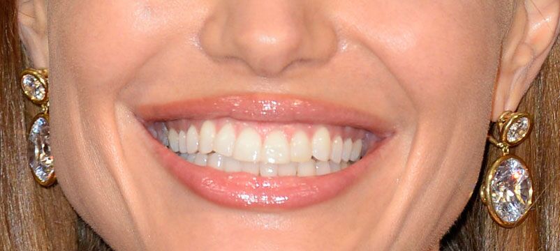 Can you identify these celebrity smiles? - Rainbow Dental